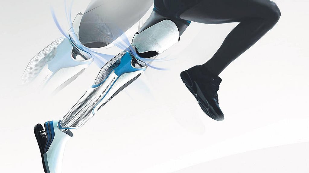 Five artificial limb units to come up at teaching hospitals across Andhra