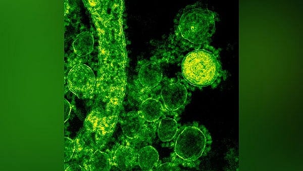 ICMR team reaches Kozhikode after Nipah case confirmation