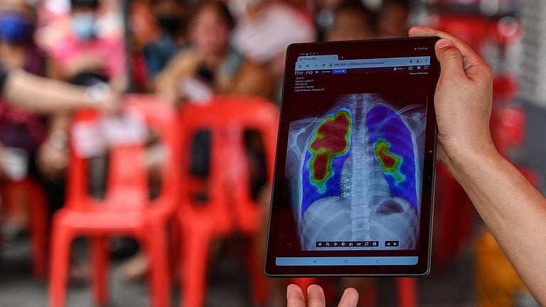 Over 32K living co-infected with HIV and TB in 2024, admits Centre