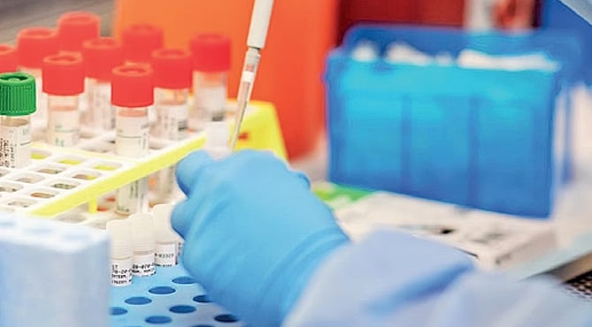 Sudanese national tests negative for Ebola