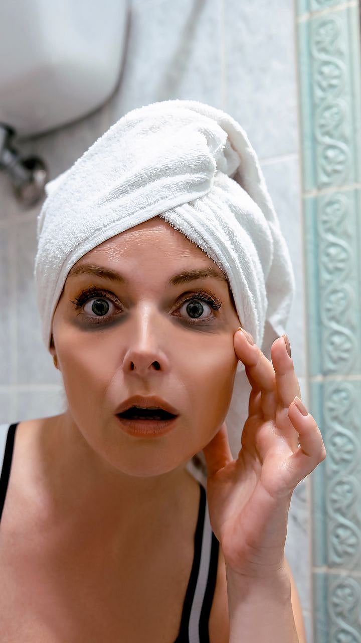 Dark circles home remedies |डोळ्यांखालच्या डार्क सर्कल्समुळे त्रस्त ...