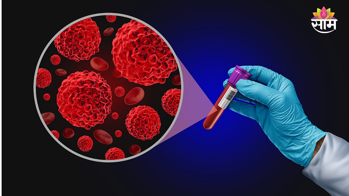 Blood Cancer : रात्री घाम येणं, त्वचेवर निळे डाग दिसणं आणि...! ब्लड ...