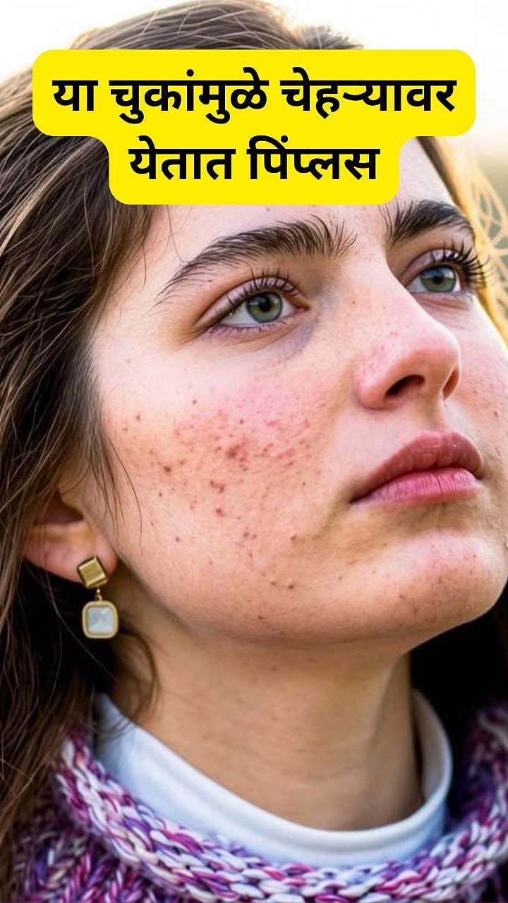 या 5 चुकांमुळे चेहऱ्यावर येतात पिंपल्स |5 chukanmule chehryavar pimples ...